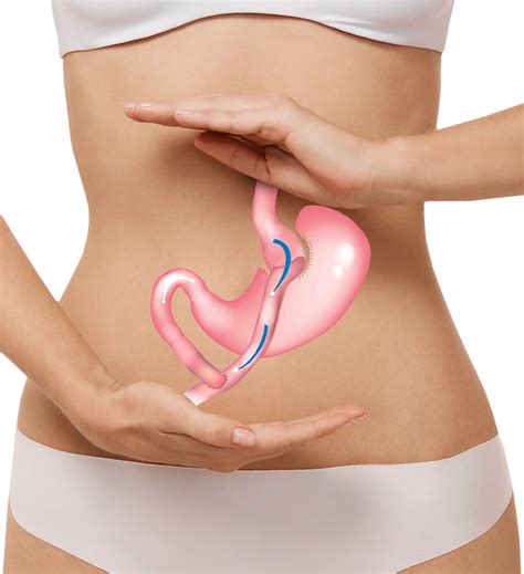 Gastric Bypass Effective Weight Loss Surgery Shape Surgery