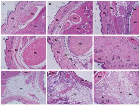Figure 3 From Interferon Alpha Beta Deficiency Greatly Exacerbates Arthritogenic Disease In Mice