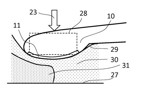 Methods For Characterizing Vaginal Tissue Elasticity Eureka Patsnap