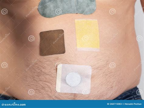 Various Medical Plasters Are Glued On The Human Body Plaster From