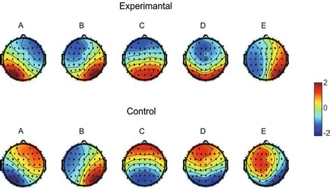 Mean Normalized Topographical Maps Of Microstate Classes A B C D Download Scientific