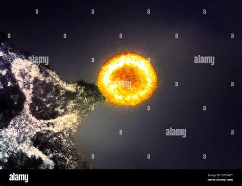 Colorized Transmission Electron Micrograph Of An Hiv 1 Virus Particle Yellow Gold Budding From