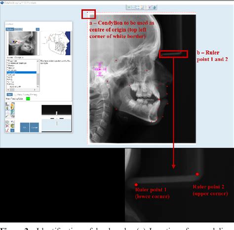 Figure 2 From Human Examination And Artificial Intelligence In Cephalometric Landmark Detection