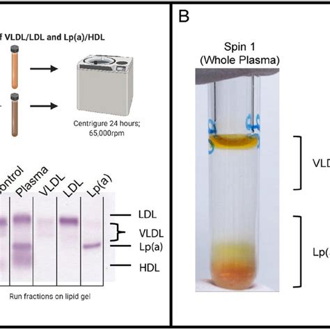 Small Volume Lipoprotein Isolation Workflow A Workflow For