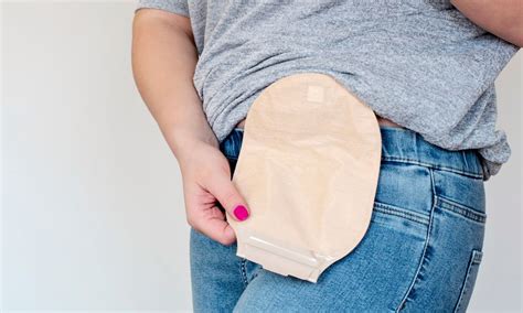 Do Ostomy Bags Smell What You Need To Know About Odor Control Carbou