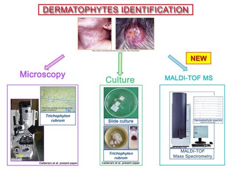 Identification Of Dermatophyte Species After Implementation Of The In