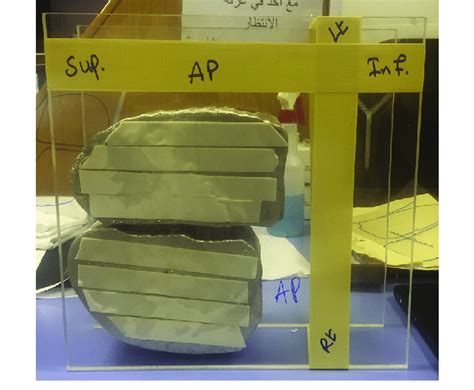 Cerrobend Shielding Blocks Fixed On A Tray To Be Used For Treatment Download Scientific Diagram