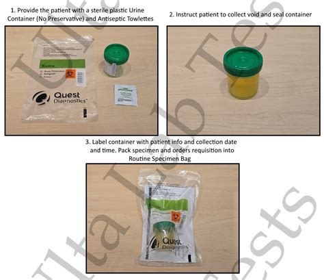 Albumin Random Urine Test With Creatinine Ulta Lab Tests