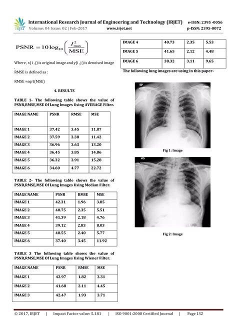 Comparison On Average Median And Wiener Filter Using Lung Images Pdf
