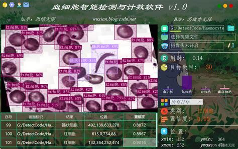 血细胞智能检测与计数软件（pythonyolov5深度学习模型清新界面版） 思绪无限 博客园
