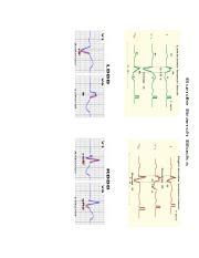 Left Right Bundle Branch Blocks Pptx Bundle Branch Blocks Course Hero