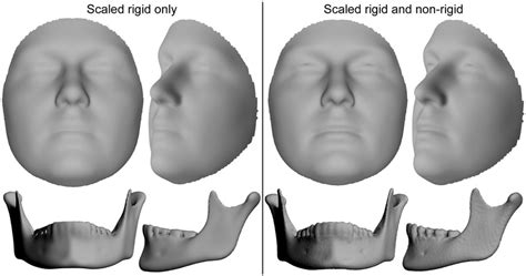 comparison of scaled rigid and scaled rigid plus non rigid registration