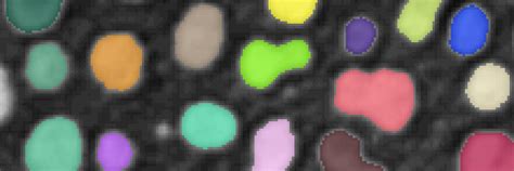 Image Segmentation The Image Analysis Field Guide