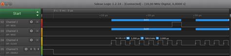 Bad Default Value For SPI Clock Speed Max Speed Hz Messing Up