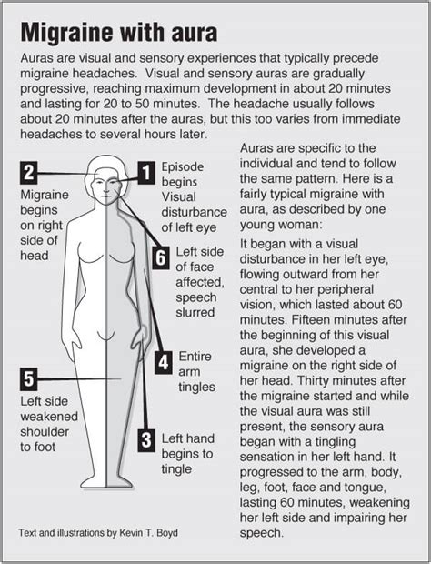 Migraine With Aura Pointfinder Health Infographics