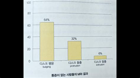 통증박사 안강입니다 만성통증 경보 턱관절문제 바른걸음걸이 질병 허리 다리 척추협착증 디스크탈출증 고통 Mri 과민화 치료예후 심각한당뇨 뇌병변