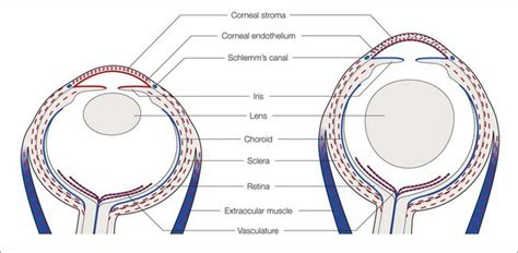 Surface Ectoderm Eye Eczema Eyes Causes Symptoms And Treatment Sdna