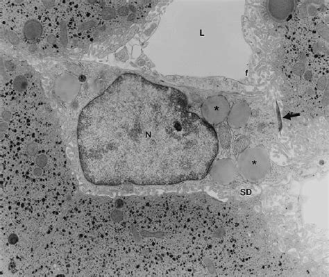 A Stellate Cell As Usual Situated Within The Space Of Disse That Is
