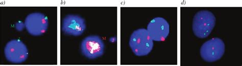 Binucleated Lymphocytes After Fish With Chromosome Specific Probes A
