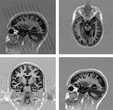 Structural Neuroimaging Neupsy Key