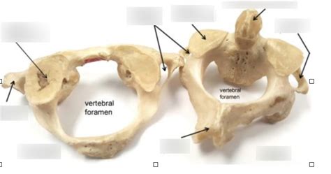Atlas And Axis Diagram Quizlet