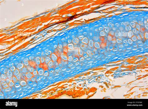 Elastic Cartilaginous Tissue From The Ear Showing Chondrocytes Elastin Fibers And Matrix