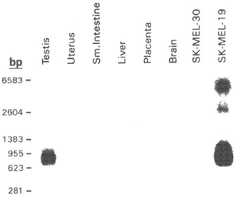 Isolated Nucleic Acid Molecule Encoding An Esophageal Cancer Associated Antigen The Antigen