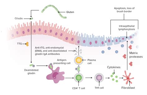 Celiac Stool Appearance