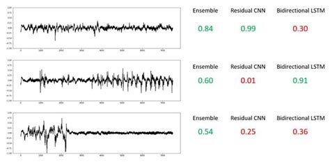Epileptic Recordings From Three Different Patients In The Testing Download Scientific Diagram