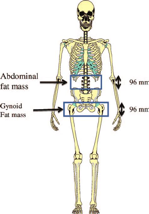 Estimates Of Abdominal And Gynoid Fat Mass By Dexa From The Total Body Download Scientific