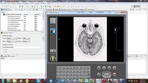 Dicom Viewer For Android Free Download Greatwood