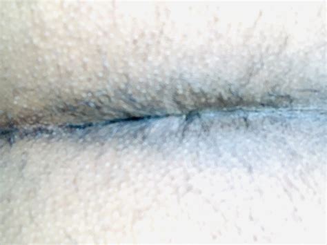 Close Up Asshole 9 Pics XHamster