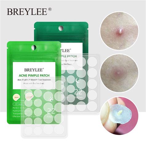 Ready Breylee Acne Pimple Patch 22 Patches Shopee Philippines