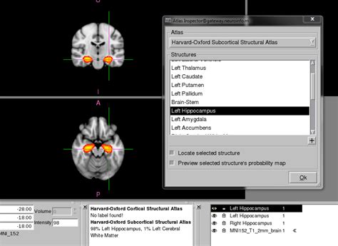 ROI Analysis Wei S Menu For Neuroimage 0 0 1 Documentation