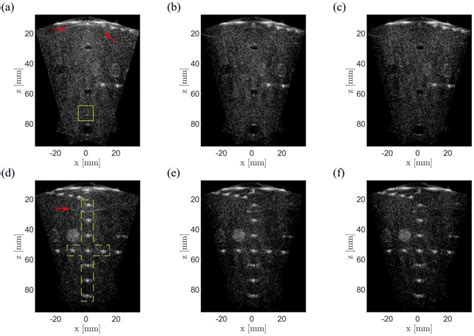 On The Arrays Distribution Scan Sequence And Apodization In Coherent Dual Array Ultrasound