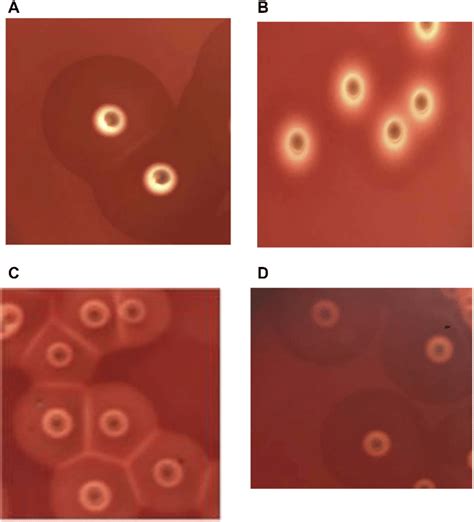 Hemolytic Phenotype Comparative Analyses Of Staphylococcus Aureus On Download Scientific