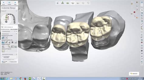 Layout Lab 3 3 3 Downkfil
