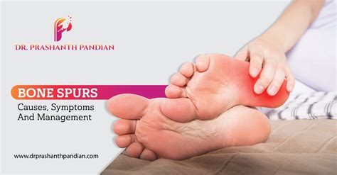 Bone Spurs Causes Symptoms And Management Dr Prashanth Pandian