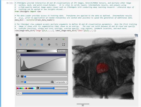 Monai And Itkwidgets Getting Started
