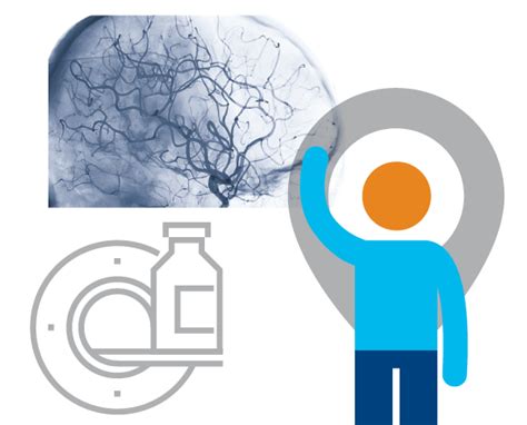 Interventional Radiography Book Radiology