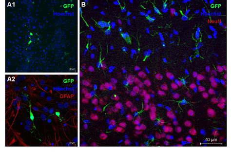 Figure 5 From Gene Transfer To Rat Cerebral Cortex Mediated By Polysorbate 80 And Poloxamer 188