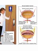 Overactive Bladder