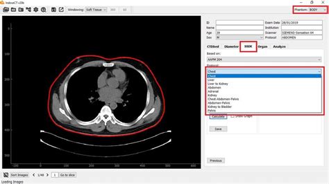 There Are 10 Options For Selecting The Protocol For The Body Phantom Download Scientific Diagram