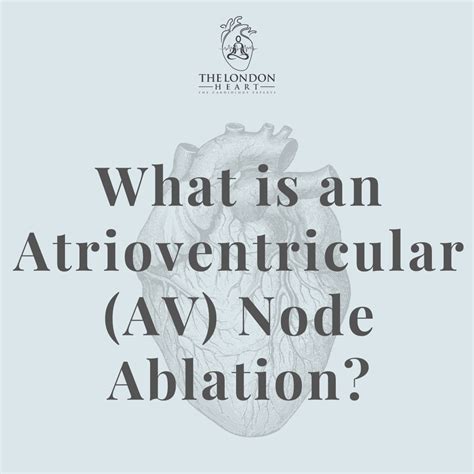 What Is Atrioventricular Av Node The London Heart
