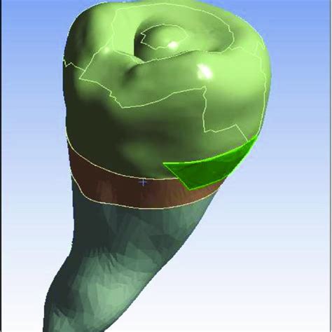Three Dimensional Finite Element Model Of Premolar Tooth With Cavity Download Scientific Diagram