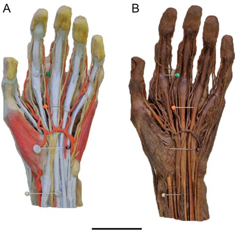 Cadaver Dissection Human Body