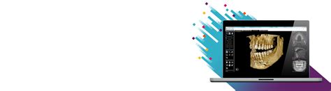 Cs 8200 3d Access Advanced Cbct Imaging From Carestream Dental