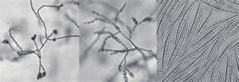 一、高粱真菌病害（diseases Caused By Fungi）植保专题库