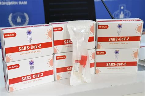 АШУҮИС Эхний ээлжинд 15 мянган оношлуурыг хэрэглээнд нэвтрүүлнэ