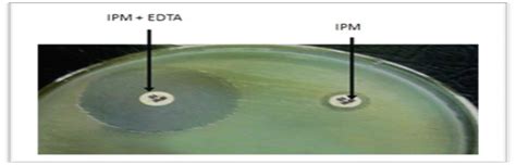 Positive Combined Disc Test For Detection Of Mbl Activity The Test Download Scientific Diagram